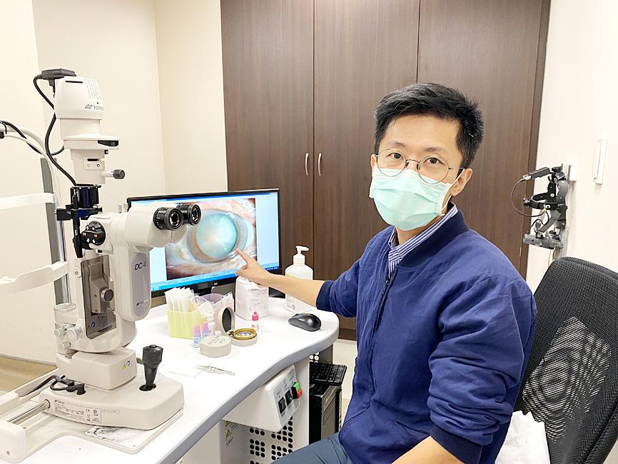 Seek early treatment for cataracts: ophthalmologist - Taipei Times