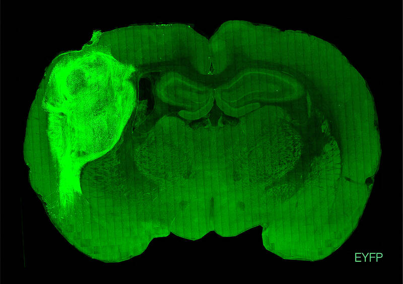 Human brain cells implanted in rats offer research gold mine - Taipei Times